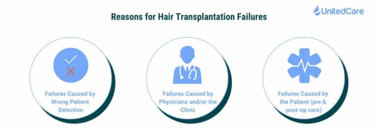 3 Hair Transplant Failures + Why and How Often do they happen?