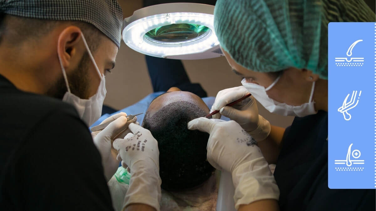 The Complete Hair Transplant Guide For Men Procedure Costs Risks