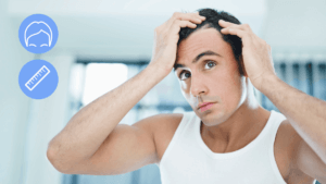Uneven Hairlines - Why They Happen and How to Fix Them