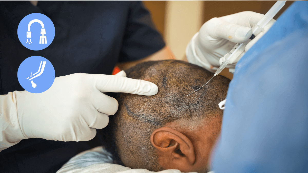 Quick Guide To Neograft Hair Transplants Cost Effectiveness Risks
